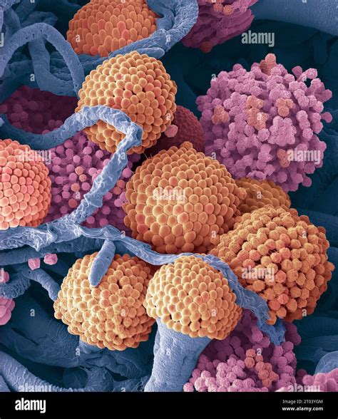 Drug Resistant Aspergillus Coloured Scanning Electron Micrograph Sem Magnification X1200