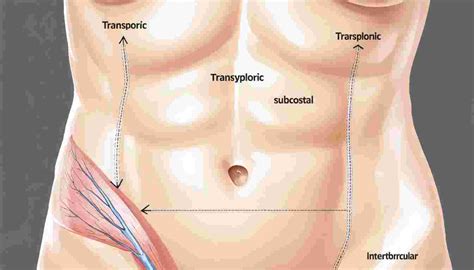 Transpyloric Plane Anatomy And Clinical Importance