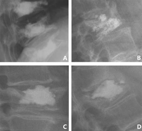 The Zk And Sp Classification This Figure Is Reproduced From Jamjoom Et