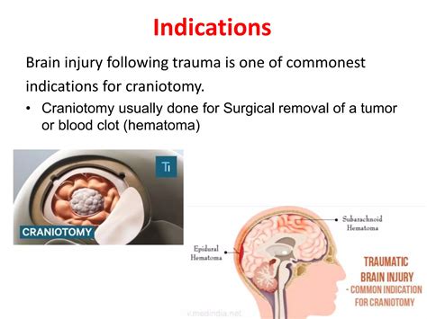 Craniotomy Pptx