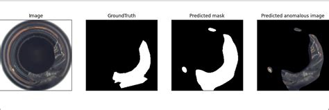 Sub Image Anomaly Detection With Deep Pyramid Correspondences 論文筆記 Rozenchen Medium