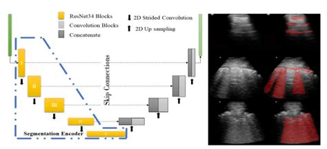 Architecture Of The Segmentation Encoder Left And Segmentation