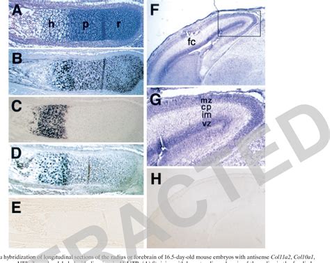 Figure 3 From A Krüppel Associated Boxzinc Finger Protein Nt2 Represses Cell Type Speciﬁc