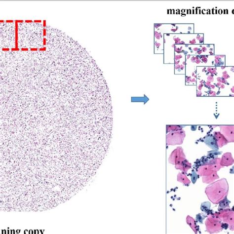 Pdf Automatic Model For Cervical Cancer Screening Based On Convolutional Neural Network A