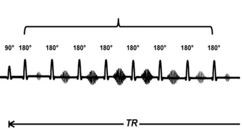 Basic Mri Sequence Types Conventional And Fast Spin Echo Part 2 Flashcards Quizlet