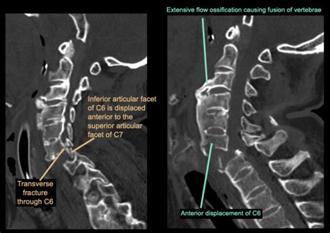 CT Case LITFL CT Scan Interpretation