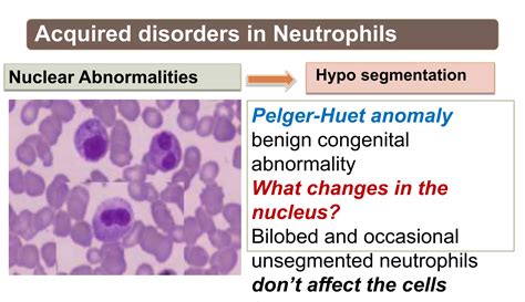 Qualitative Defects Of Granular White Cells Ppt