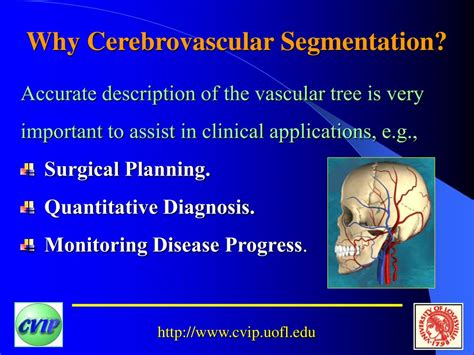Ppt A New Automatic Approach For Cerebrovascular 3 D Volume Segmentation With New Mip Based