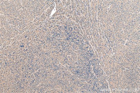 Ihceasy Afp Ready To Use Ihc Kit Khc0380 Proteintech 武汉三鹰生物技术有限公司