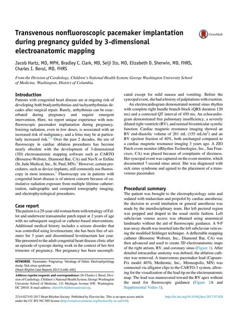 Solution Transvenous Nonfluoroscopic Pacemaker Implantation During Pregnancy Guided By 3
