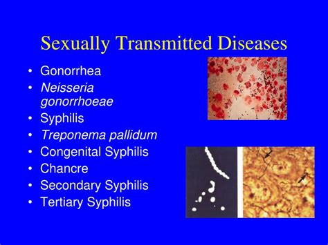 Ppt Person To Person Microbial Diseases Powerpoint Presentation Free