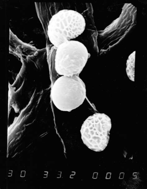 Electron Micrograph 18