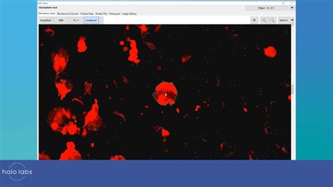 Halo Labs On Linkedin Biologics Particleanalysis