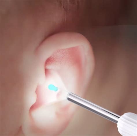 nettoyeur auriculaire connecté compatible ios and android xiaros