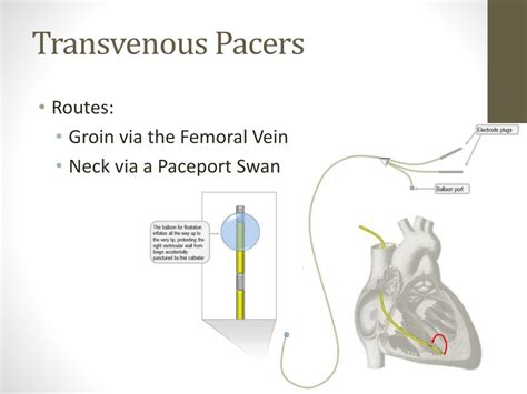 Ppt Ekgs And Pacemakers Powerpoint Presentation Free Download Id