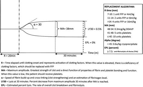 Thromboelastography Teg Wikem