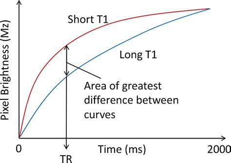 【医学图像处理】mri t1 t2 pd 加权成像 mri t1t2 pd csdn博客
