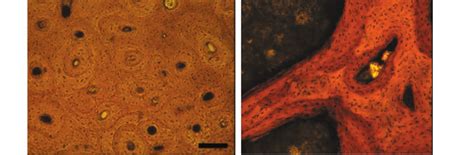 Sections Of The Tibial Cortex Left And Metaphyseal Trabeculae Right