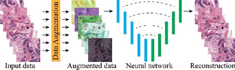 Quantifying The Effects Of Data Augmentation And Stain Color