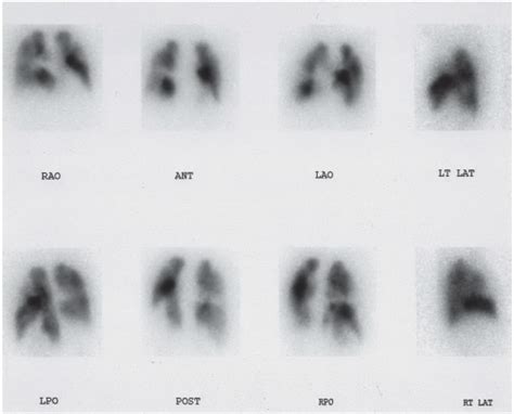 Nuclear Medicine Radiology Key