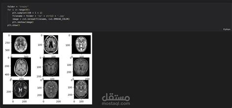 Brain Tumor Prediction مستقل
