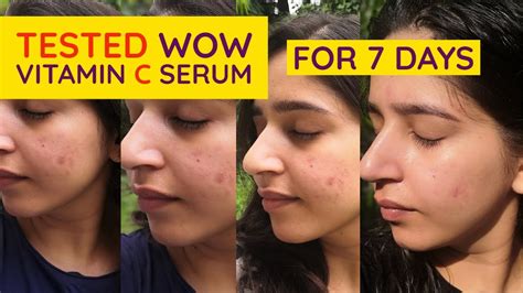 Vitamin C Before Or After Hydrating Serum At Pearl Brandon Blog
