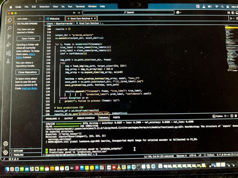 Brain Tumor Classification With Mobilenetv2 Tackling Class Imbalance And Overfitting With
