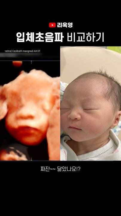 입체 초음파 실제로 얼마나 닮았을까 Youtube