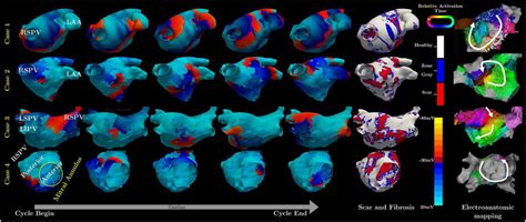 Of Simulated And Measured Flutter Circuits In Four Subjects The Download Scientific Diagram
