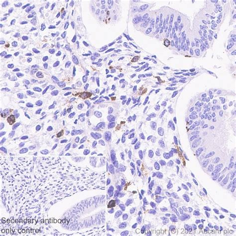 Recombinant Anti Mhc Class Ii Beta Antibody [epr11227] Ab170867 Abcam