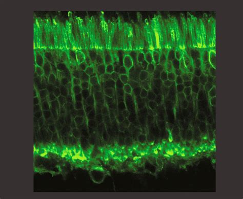 How Optogenetics Has Restored Partial Sight To A Blind Patient Cnrs News