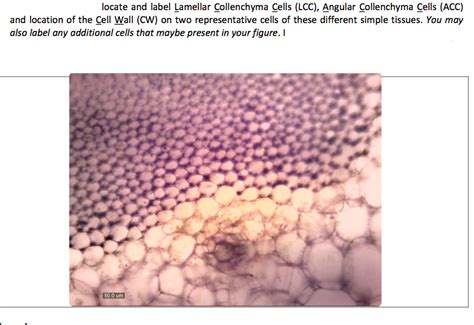 Collenchyma Tissue Labeled