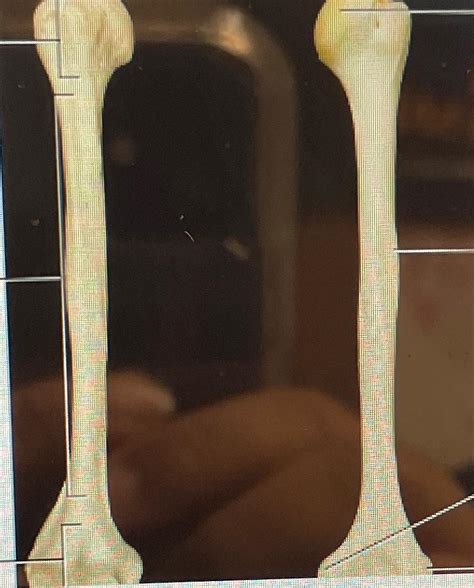 Solved Label The Structures Of The Bone