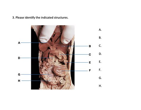 Solved Please Identify The Indicated Structures A B A Chegg