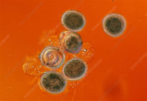 Toxocara Canis Eggs X65 On Orange Background Stock Image Z180 0093 Science Photo Library