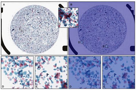 a representative example of neoplastic true negative prediction outputs