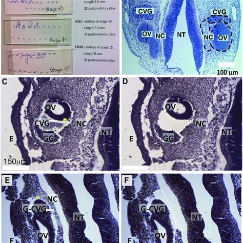 Laser Microdissection Of Ffpe Human Inner Ear Slides A Ffpe Slides