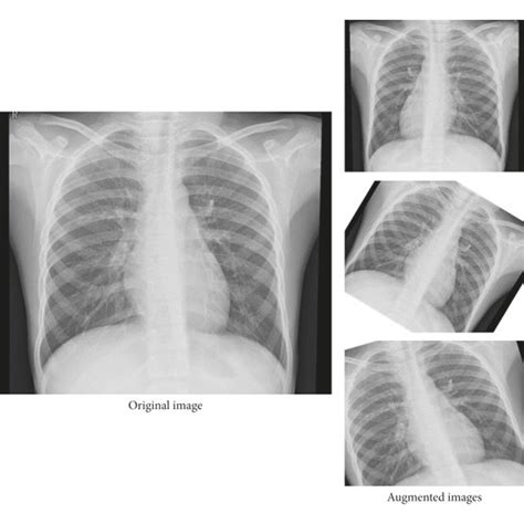 A Visual Representation Of Data Augmentation Download Scientific Diagram
