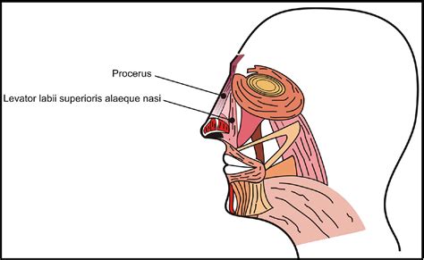 Esthetic And Anatomic Basis Of Modified Lateral Rhinotomy Approach