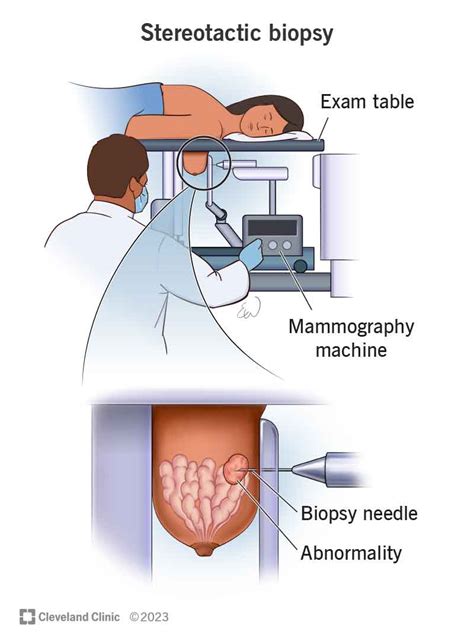 Biopsy Biology Simple