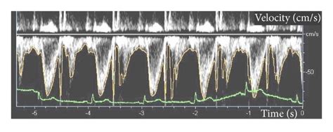 Input And Output For The System Identification Model A Doppler