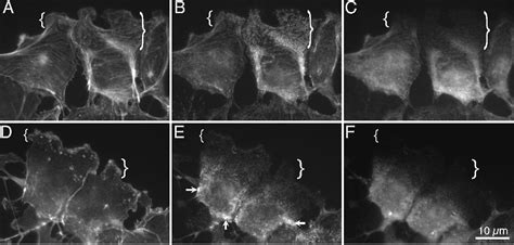 Figure 1 From The Role Of Myosin Ii Motor Activity In Distributing