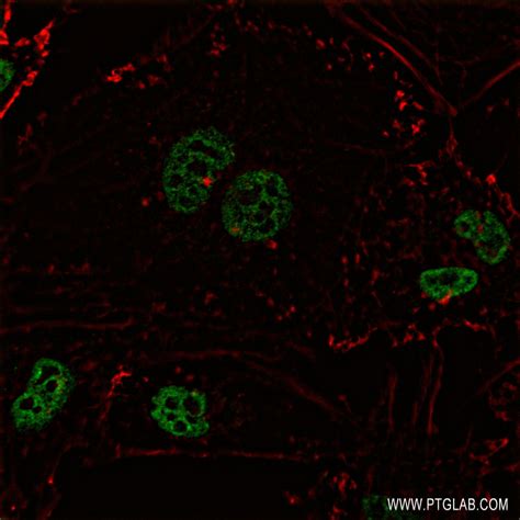 Hmgb1 Antibody 82973 1 Rr Proteintech