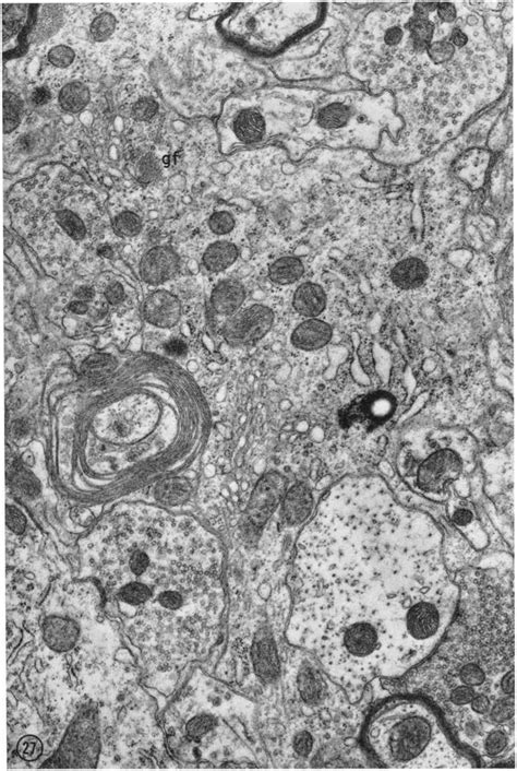 Electron Micrograph Of An Astrocyte Containing Bundles Of Fine Download Scientific Diagram