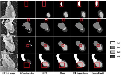 visualized segmentation results of different methods on ct test data