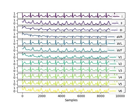 ecg — neurokit2 0 2 12 documentation