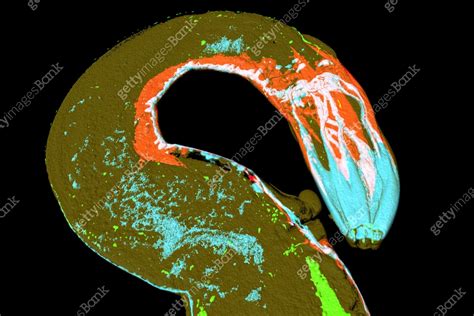 Caenorhabditis Elegans 이미지 506785536 게티이미지뱅크
