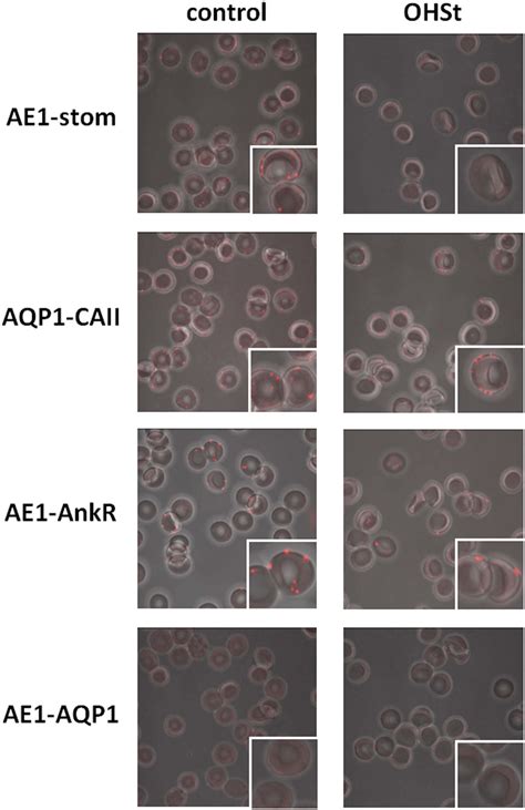 Proximity Ligation Assays For Protein Interaction Between Ae1 And Download Scientific Diagram