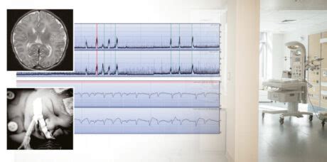New England Neonatal AEEG And Neuroimaging Workshop Neonatal Care Academy
