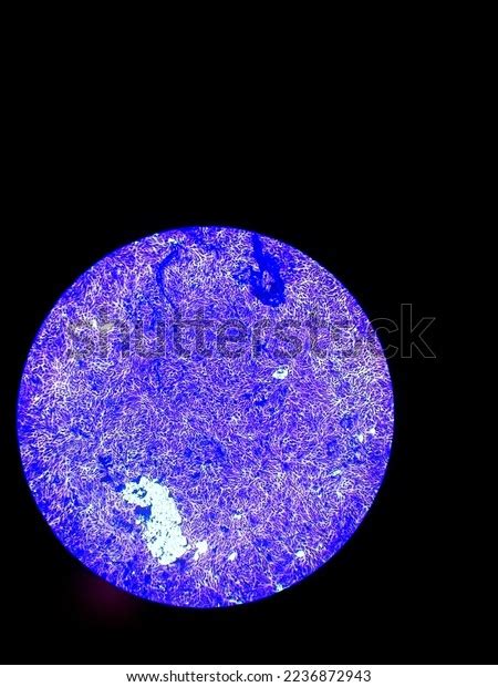 6 Viral Plaque Assay 图片、库存照片和矢量图 Shutterstock